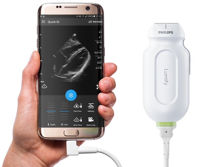 Lumify | Philips Healthcare
