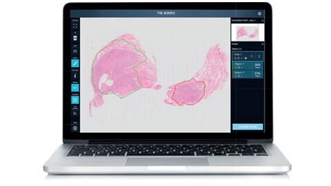 A necessidade de patologia digital | Philips Healthcare